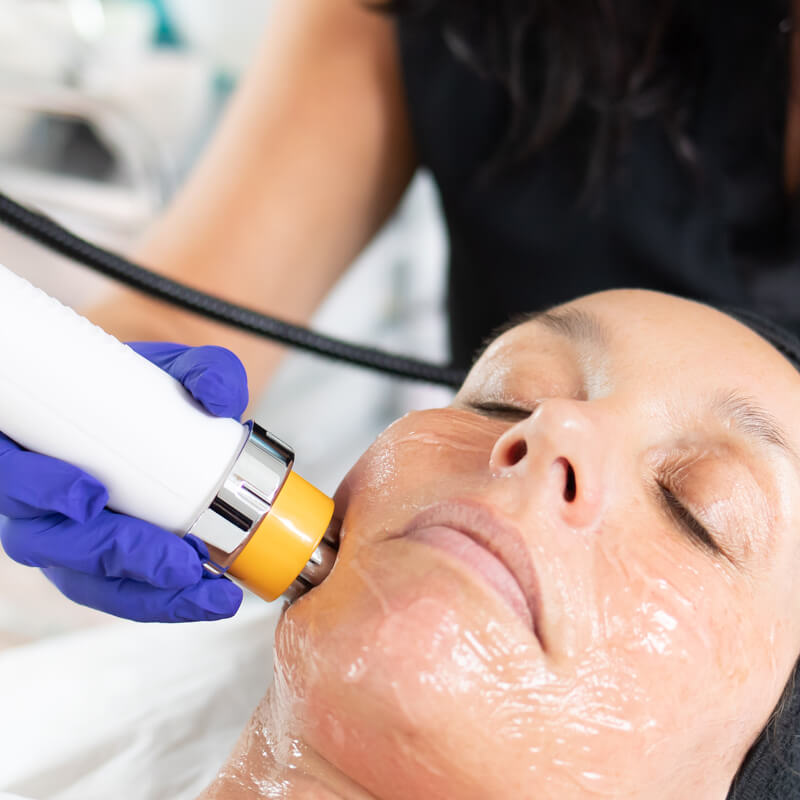 Radio Frequency - Star Treatment Skin Care Clinic